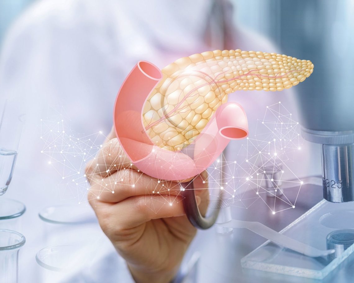 Cientistas identificam genes associados a tumores do câncer de pâncreas ...